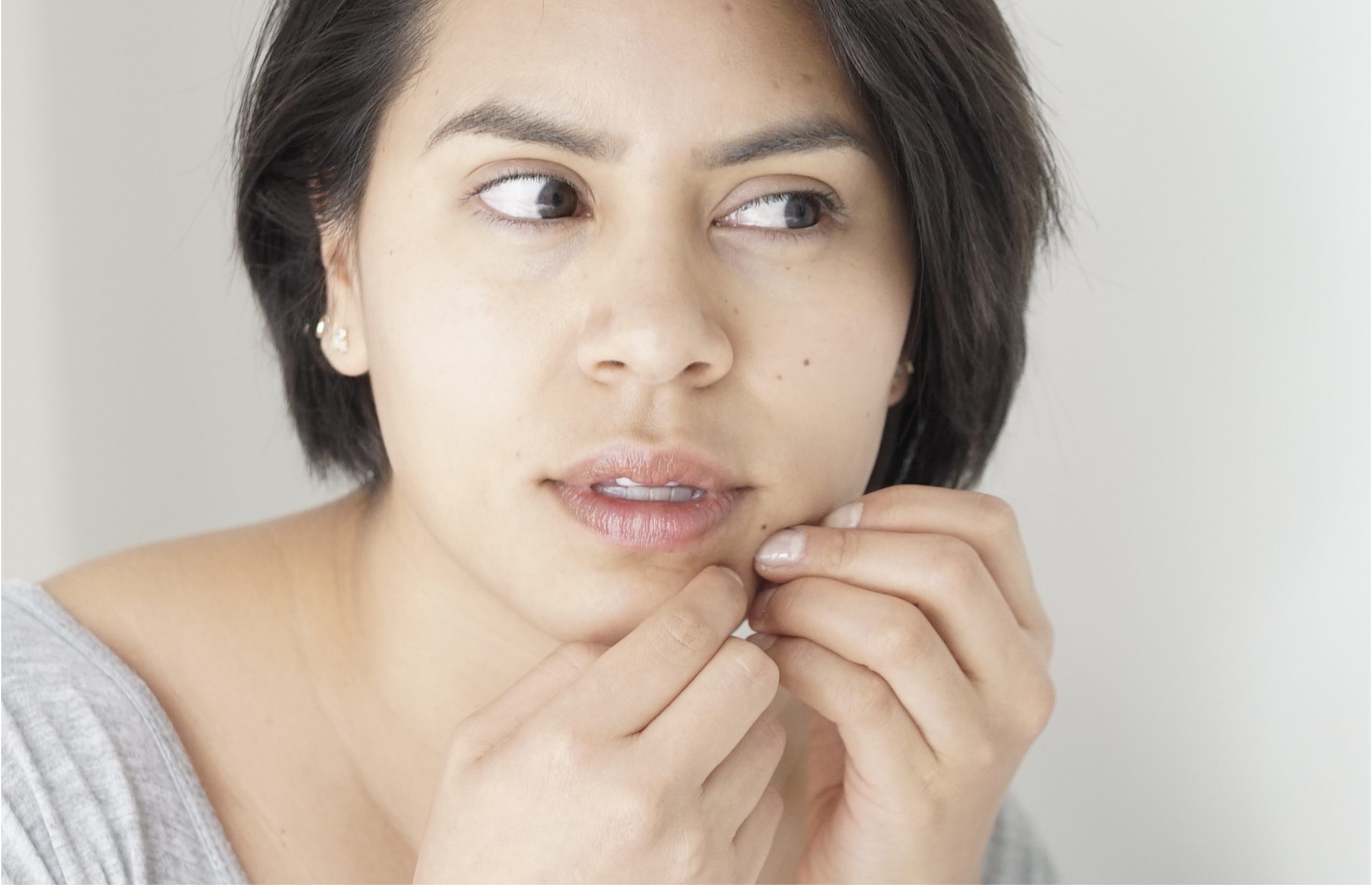 How To Break A Skin Picking Habit