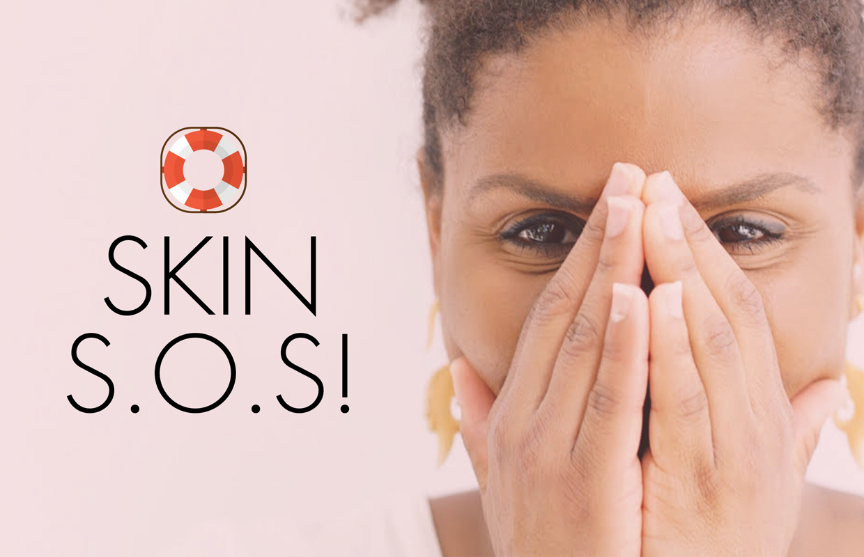5 Expert-Approved Quick Fixes for Common Skin Problems