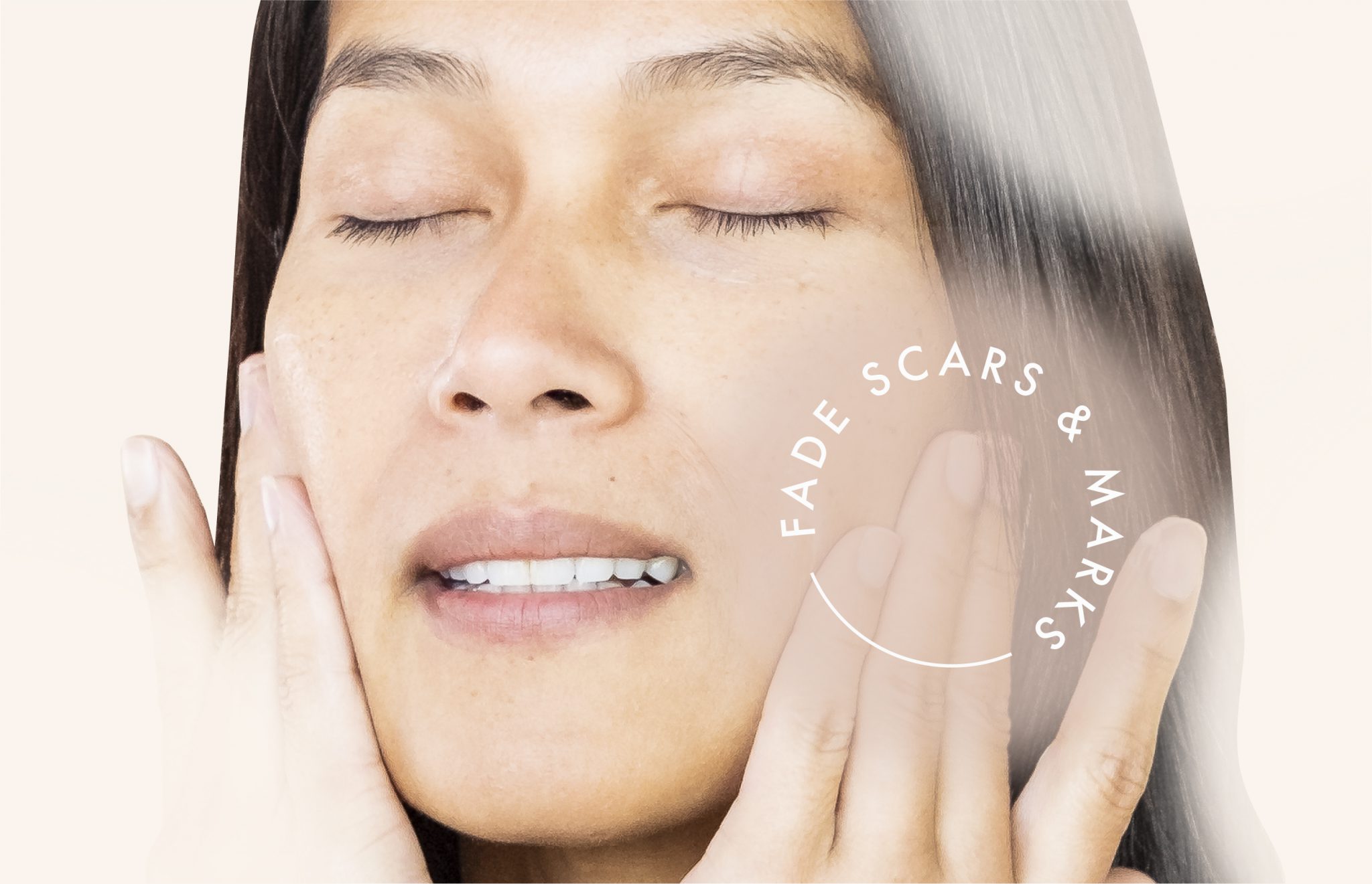 How to Fade Even the Most Stubborn Post-Breakout Marks