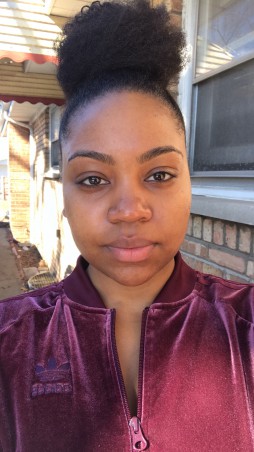 Amanda's IUD Caused Hormonal Acne—Here's How She Fixed It