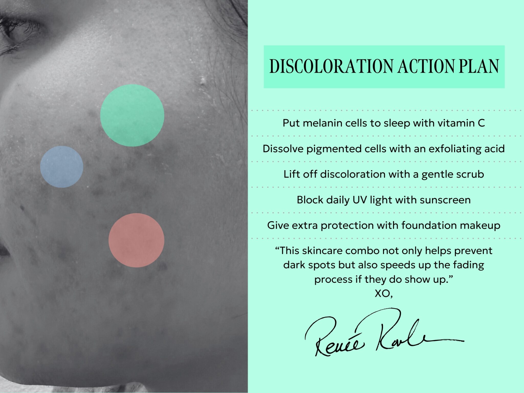 Types of Skin Discoloration & How to Get Rid of Them Fast