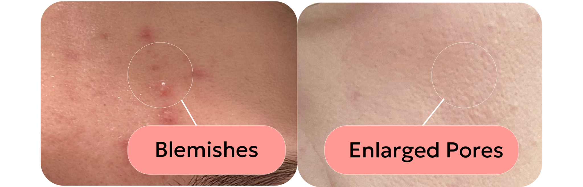 An Esthetician's Guide to Achieving Glass Skin